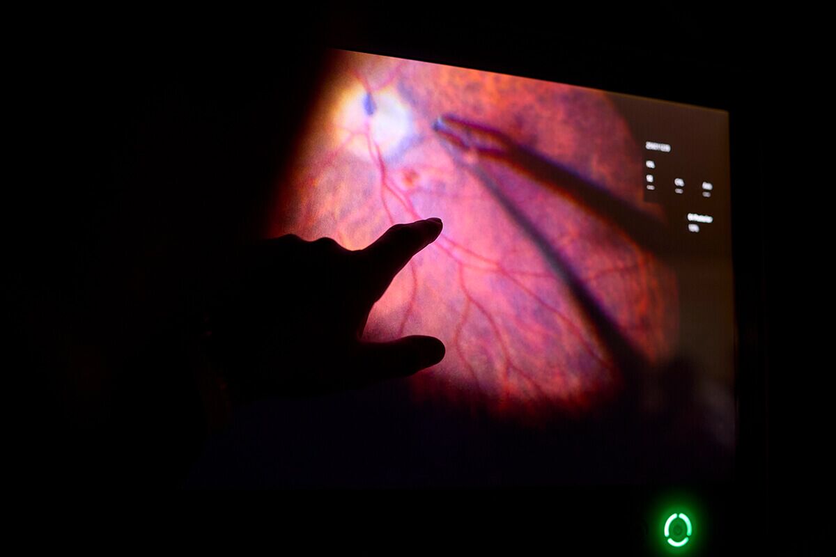 Retina Clinic London | Expert Private Retinal & Eye Care